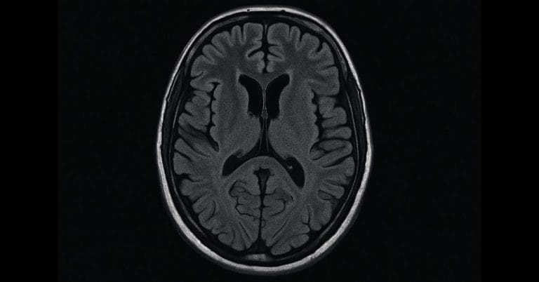 MRI Kepala/Otak - Diagnosis Akurat untuk Kondisi Neurologis - 365Sehat
